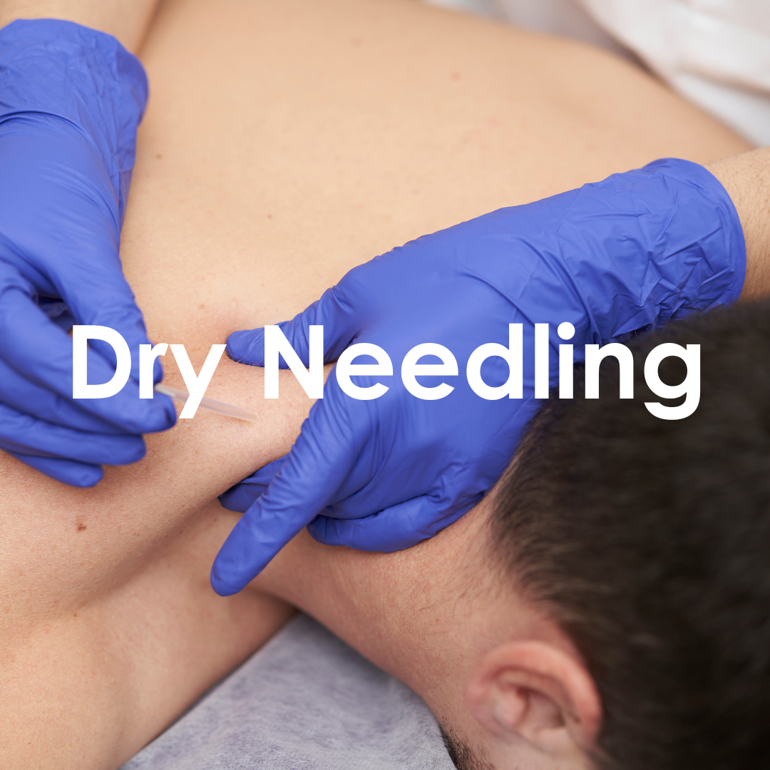 Trigger Point Dry Needling Chicago - RennWellness